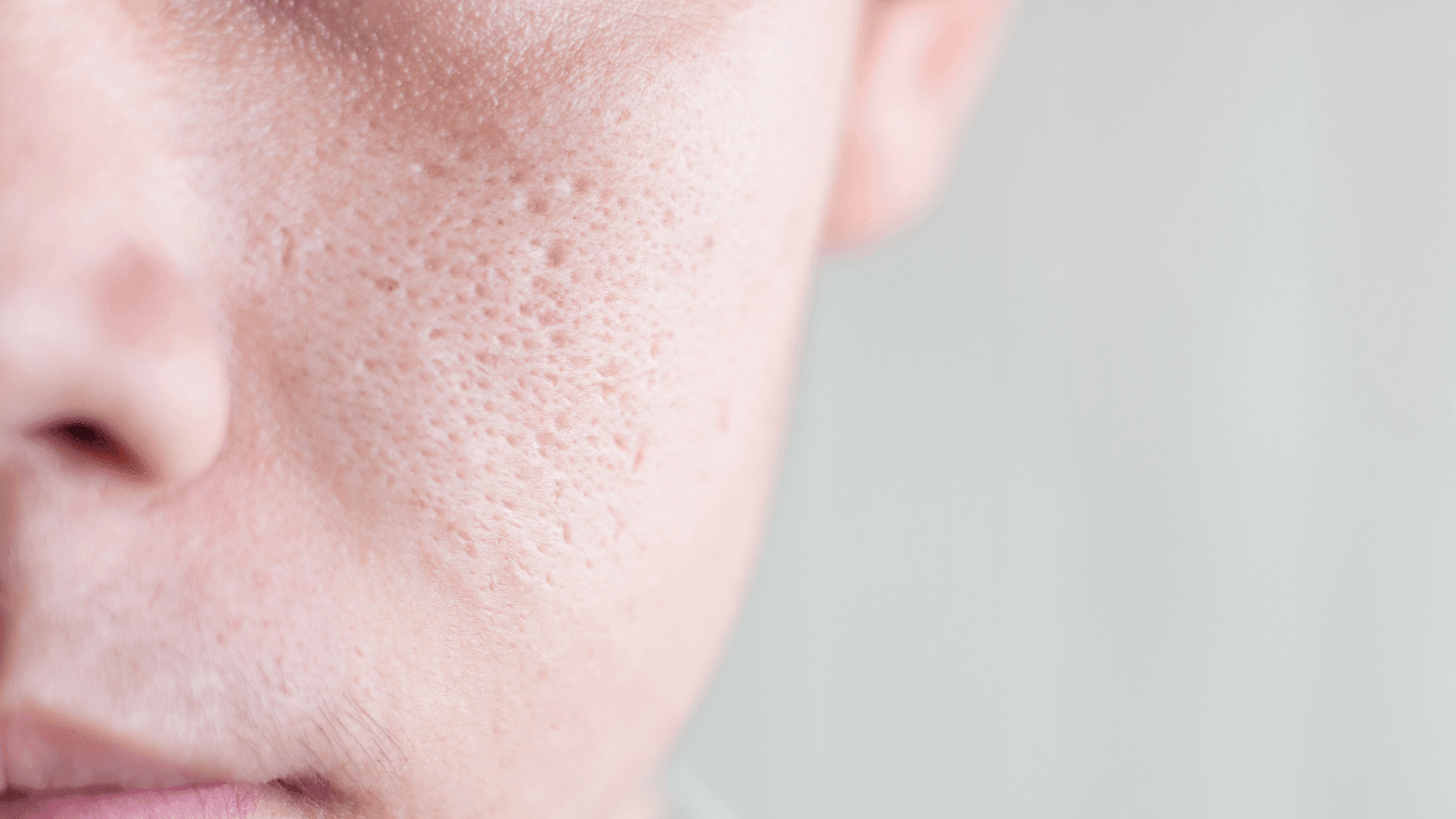 How To Shrink Your Pores – Bellini's Skin and Parfumerie